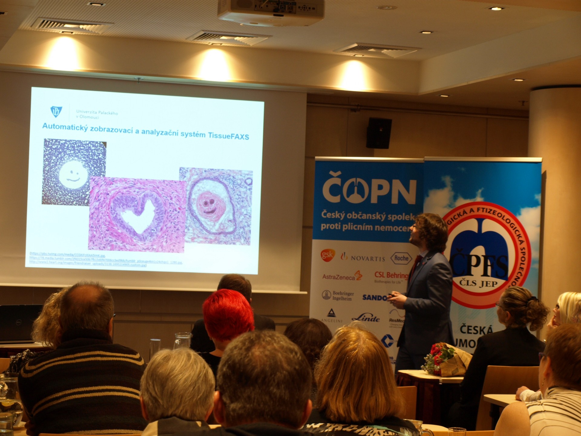 Sarkoidóza; Konference na téma Transplantace plic v Olomouci | ČOPN ...